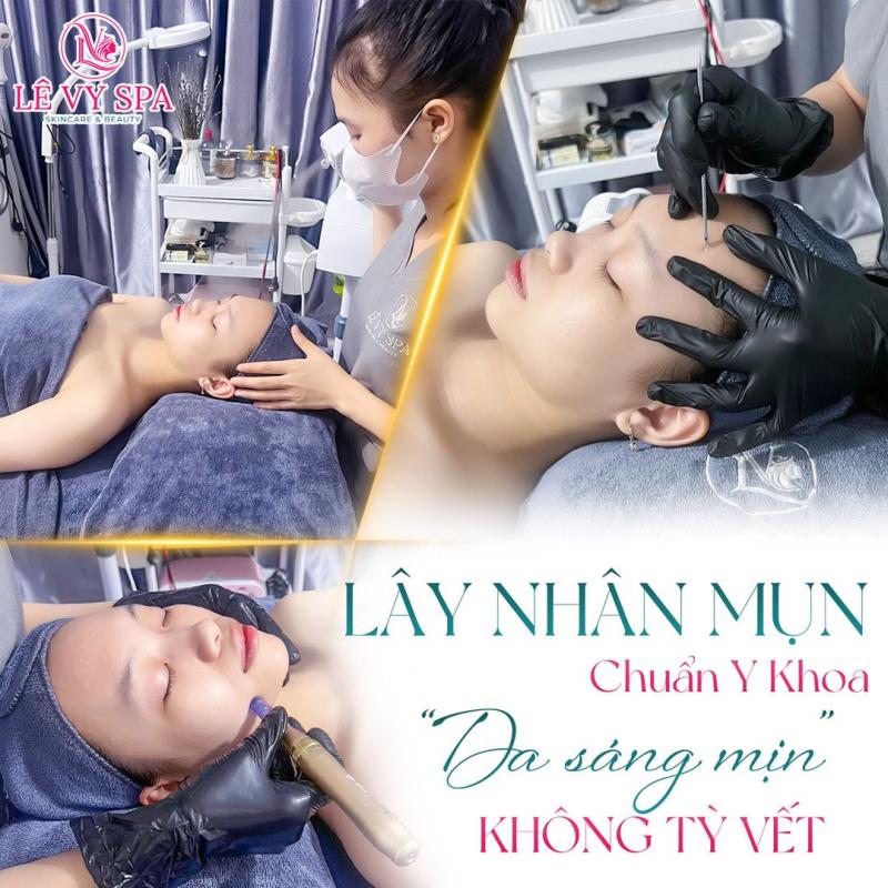 Top 5 Địa chỉ nặn mụn chuẩn y khoa ở Quận 7, TP. HCM tốt nhất - Top Chuẩn